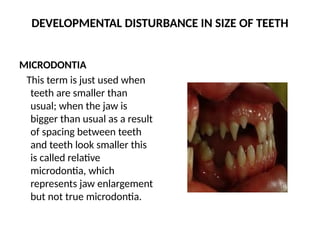 199.CONGENITAL ANOMALIES OF TEETH an INTRO.pptx