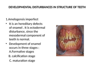 199.CONGENITAL ANOMALIES OF TEETH an INTRO.pptx