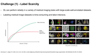 [ICIP 2022] ACT-NET: Asymmetric Co-Teacher Network for Semi-Supervised Memory-Efficient Medical ...