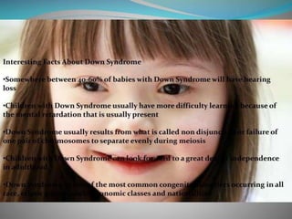 Down syndrome information 199317519.pptx