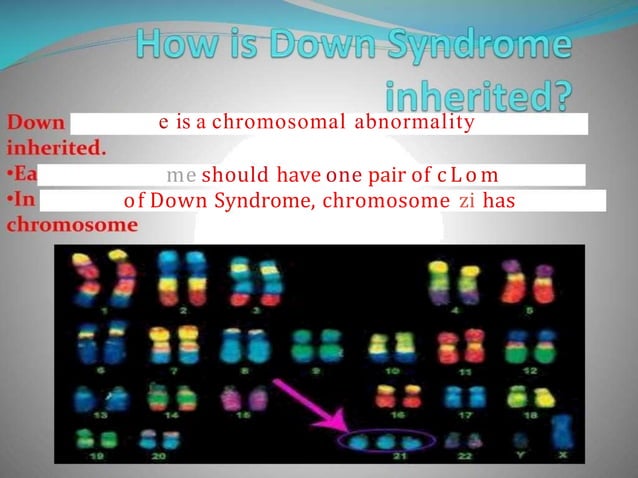 Down syndrome information 199317519.pptx | Pregnancy | Reproductive Health