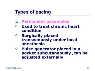 Pacemaker Operation | PPT