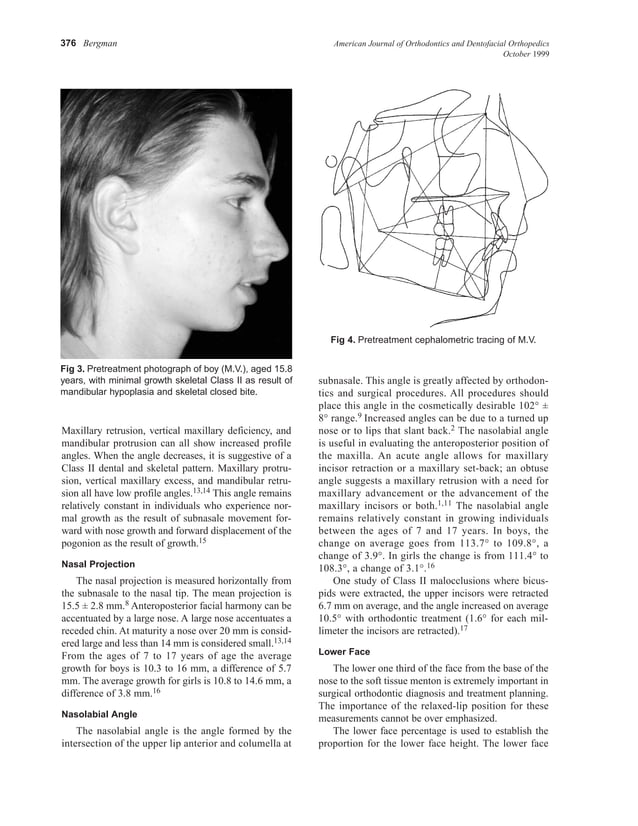 cephalometric soft tissue facial analysis | PDF | Dental Health | Diseases and Conditions