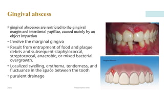 1999 CLASSIFICATION OF PERIODONTAL DISEASES.pptx