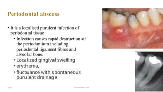1999 CLASSIFICATION OF PERIODONTAL DISEASES.pptx
