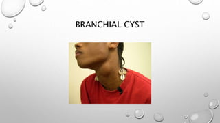 Cystic Disorders of Neck | PPTX