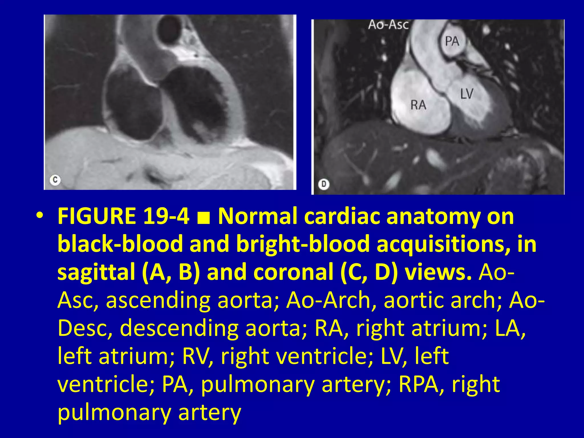 19 cardiac anatomy and Imaging techniques Dr. Muhammad Bin Zulfiqar | PPTX