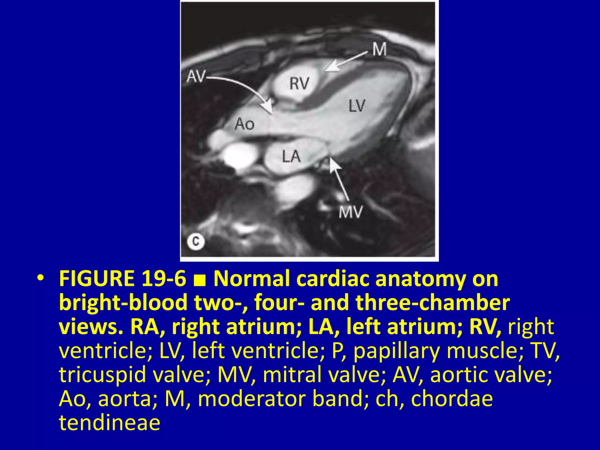 19 cardiac anatomy and Imaging techniques Dr. Muhammad Bin Zulfiqar | PPTX