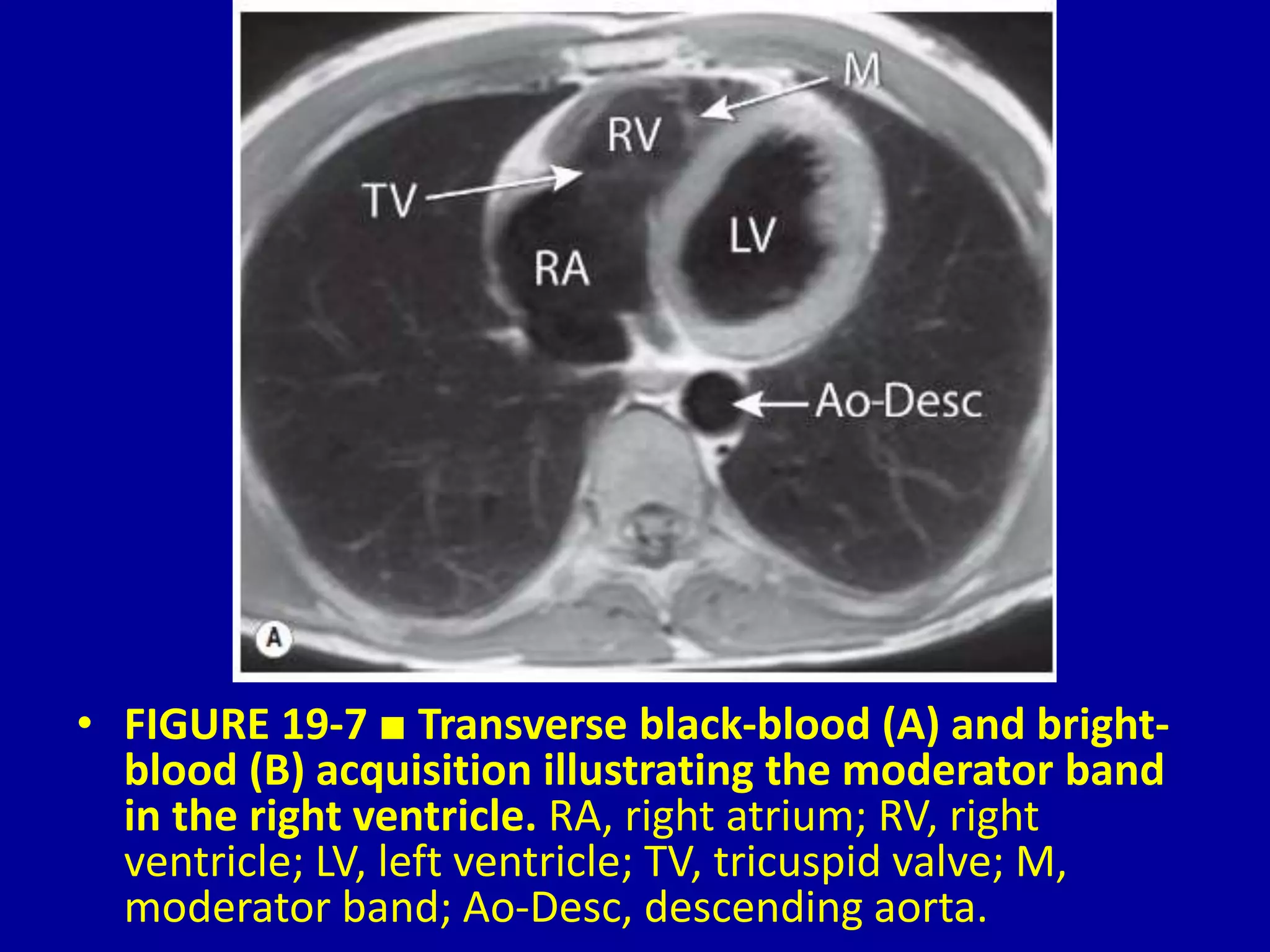 19 cardiac anatomy and Imaging techniques Dr. Muhammad Bin Zulfiqar | PPTX