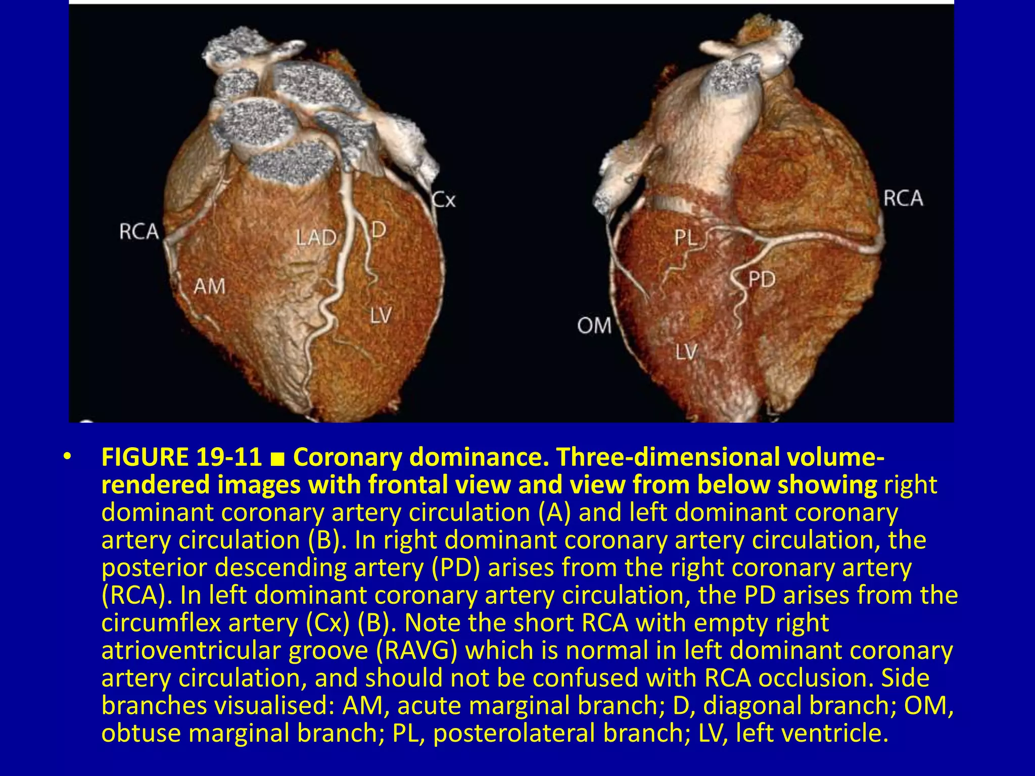 19 cardiac anatomy and Imaging techniques Dr. Muhammad Bin Zulfiqar | PPTX