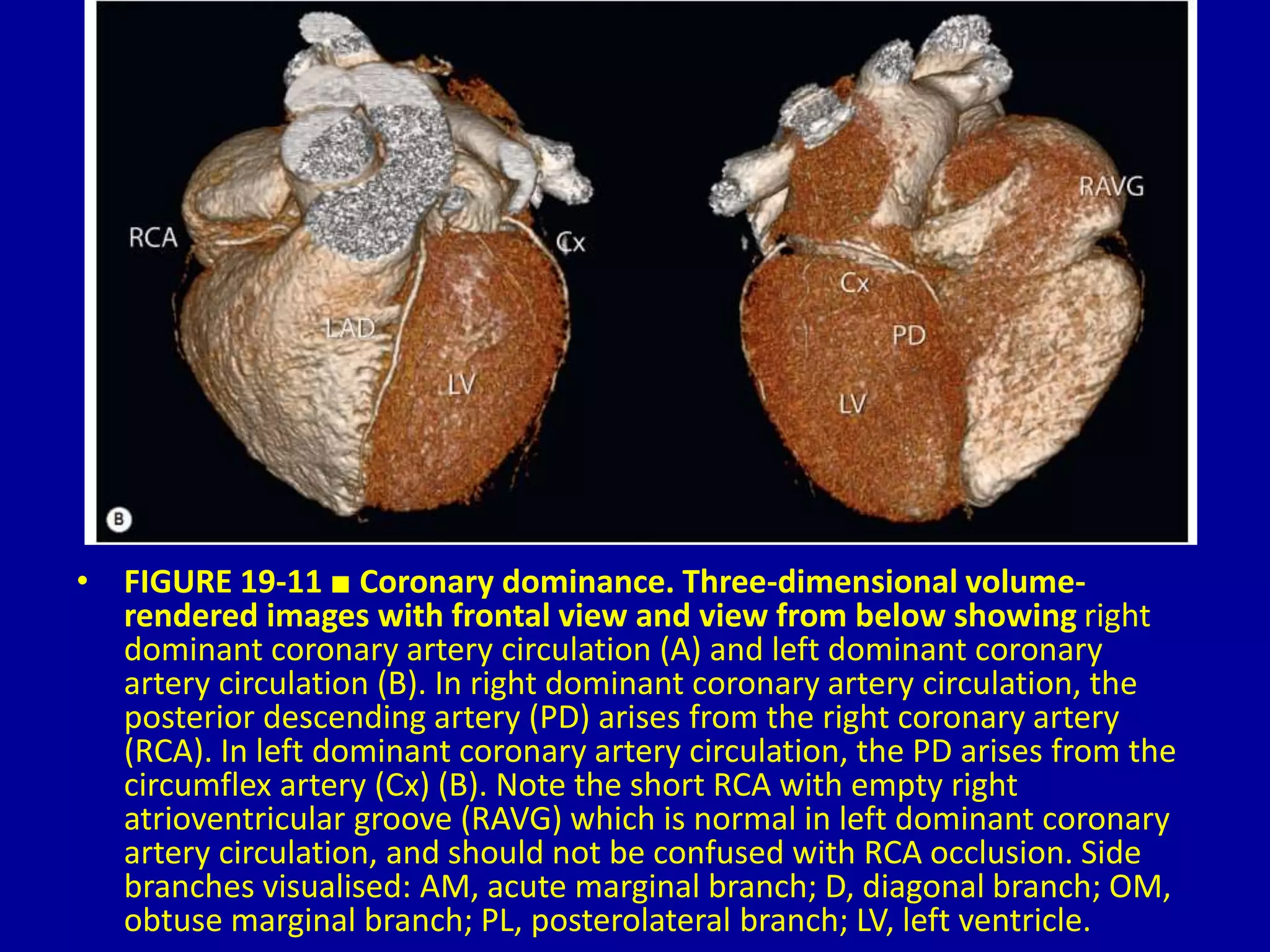19 cardiac anatomy and Imaging techniques Dr. Muhammad Bin Zulfiqar | PPTX