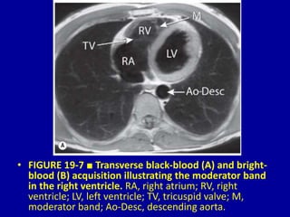 19 cardiac anatomy and Imaging techniques Dr. Muhammad Bin Zulfiqar | PPTX
