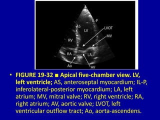 19 cardiac anatomy and Imaging techniques Dr. Muhammad Bin Zulfiqar | PPTX