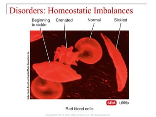 19 [chapter 19 the cardiovascular system the blood] | PPT