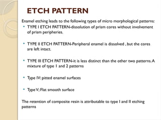 CONCEPTS OF ACID ETCHING PRINCIPLES AND OBJECTIVES.pptx