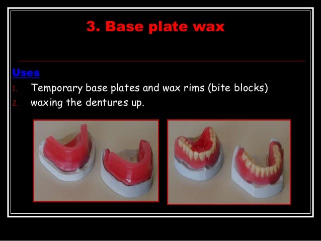 construction of dental restoration Dental waxes Casting investment de…