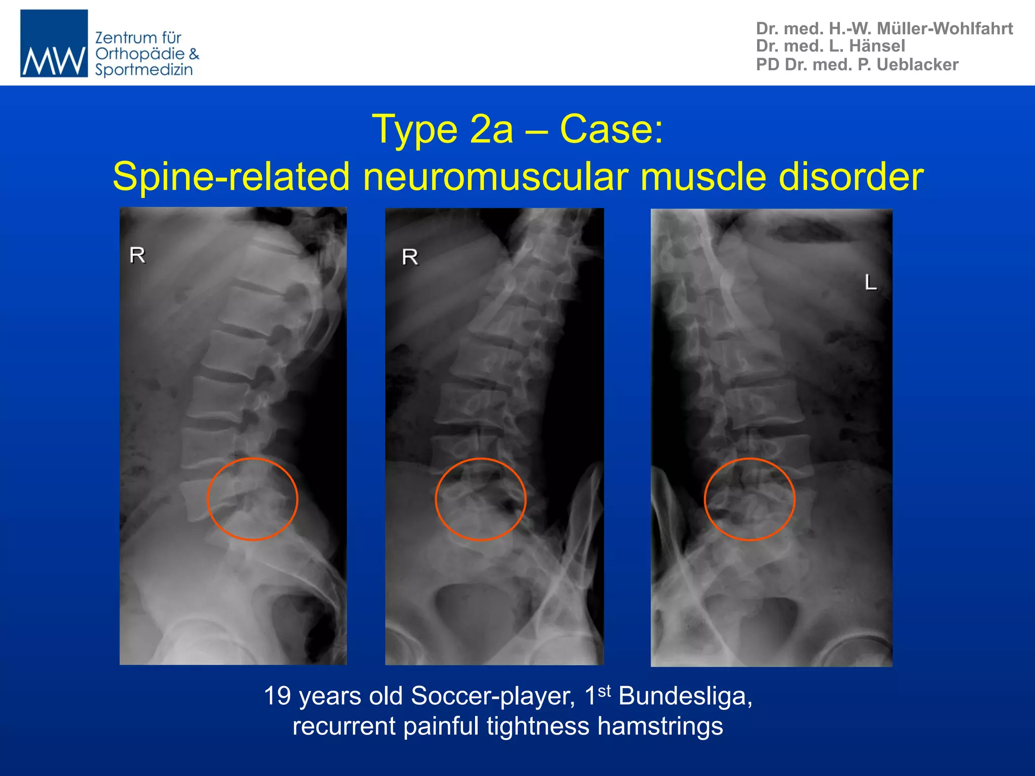 Bryan English - classification of muscle injuries in sport | PDF