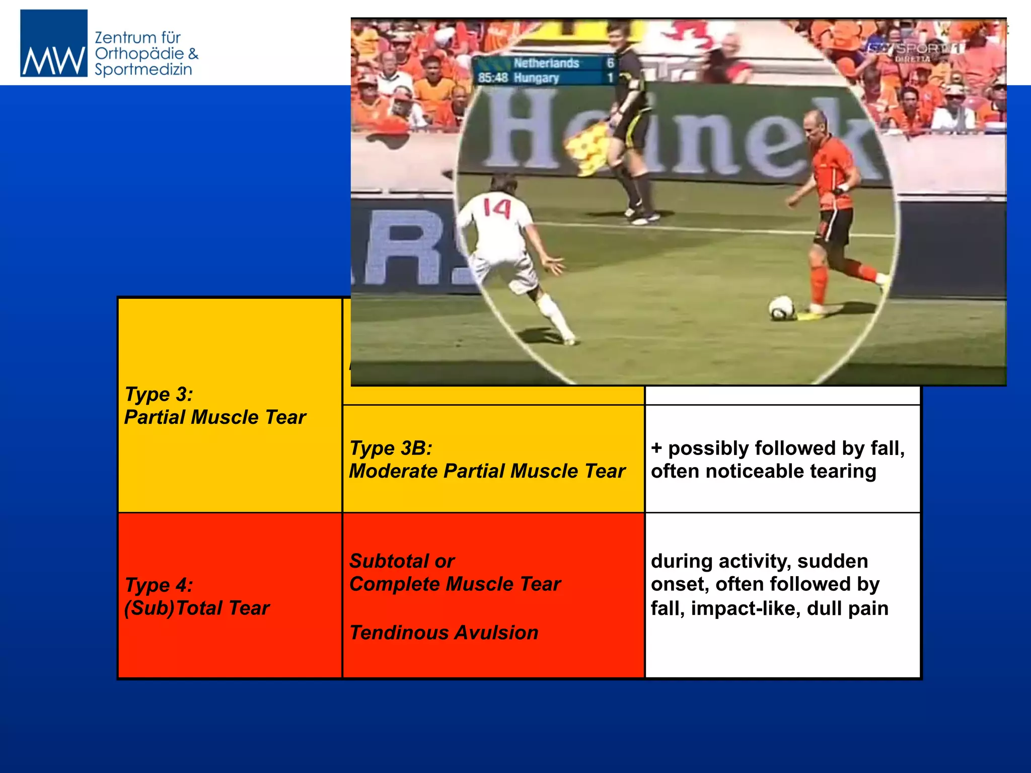 Bryan English - classification of muscle injuries in sport | PDF