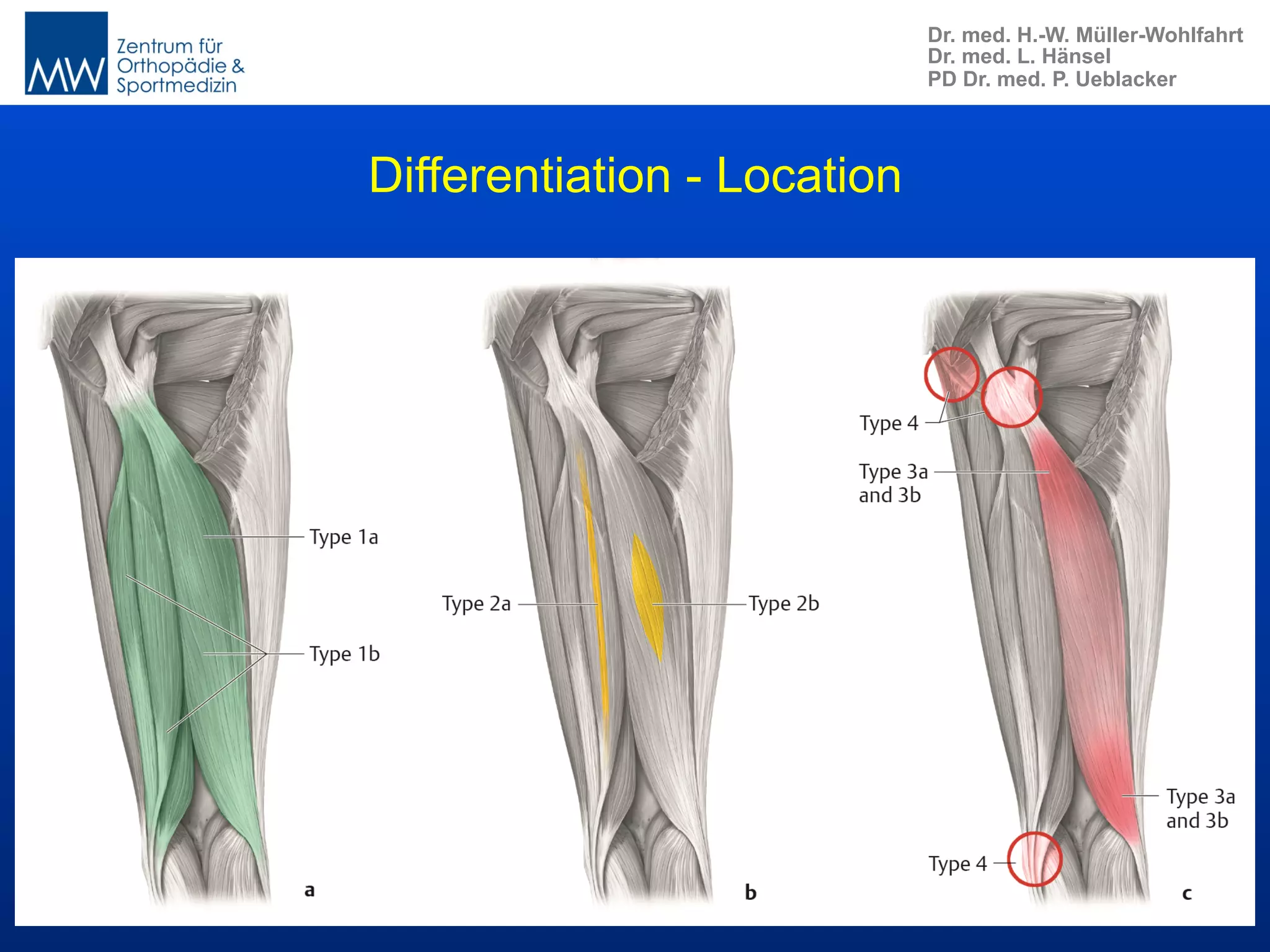Bryan English - classification of muscle injuries in sport | PDF
