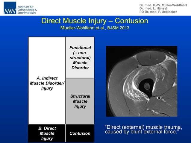 Bryan English - classification of muscle injuries in sport | PDF ...