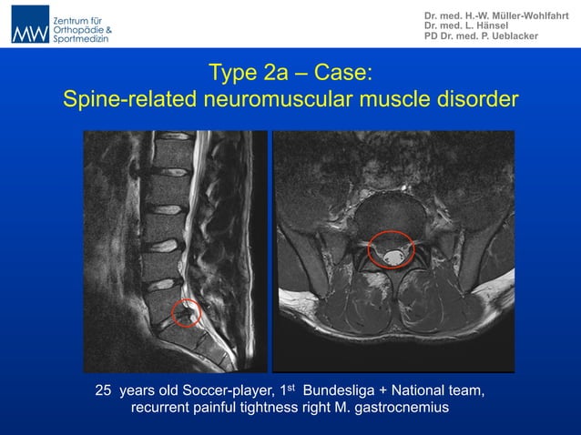 Bryan English - classification of muscle injuries in sport | PDF ...