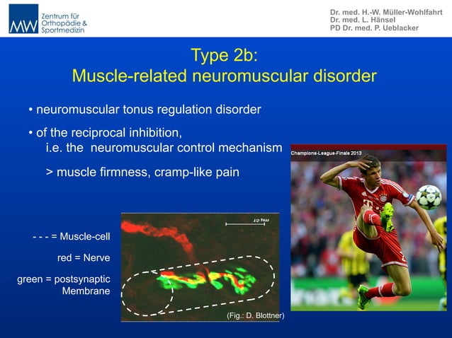 Bryan English - classification of muscle injuries in sport | PDF ...