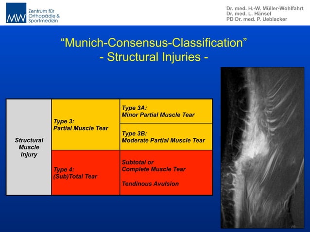 Bryan English - classification of muscle injuries in sport | PDF ...