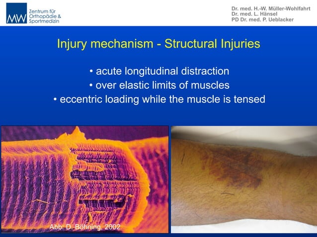 Bryan English - classification of muscle injuries in sport | PDF ...