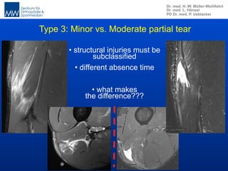 Bryan English - classification of muscle injuries in sport | PDF