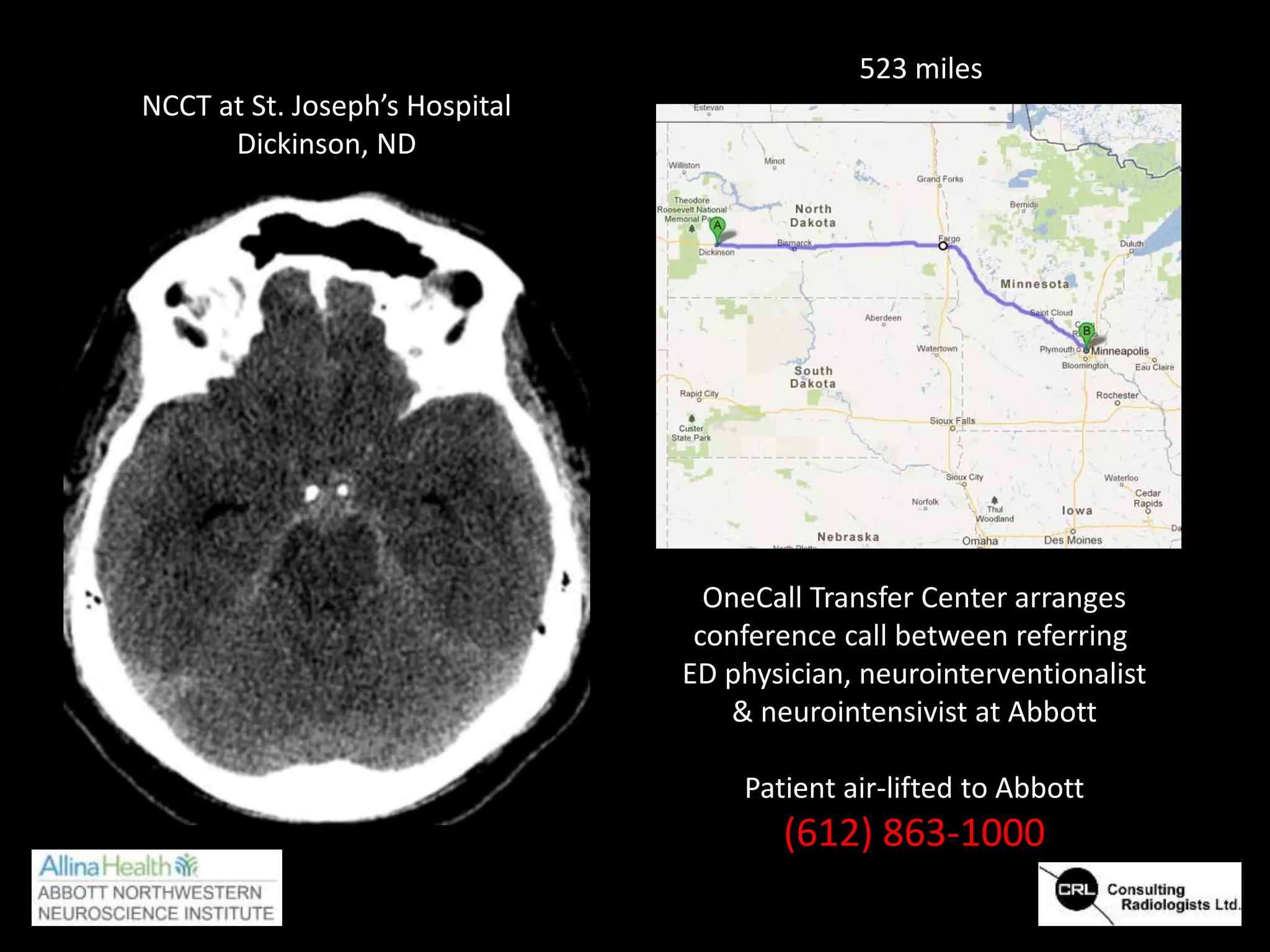 Neurointerventional Therapy for Brain Aneurysms and Acute Stroke | PPTX