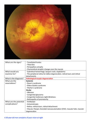 19 Objective Structured Clinical Examination (OSCE) Retina.docx