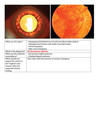 19 Objective Structured Clinical Examination (OSCE) Retina.docx