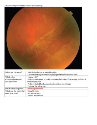 19 Objective Structured Clinical Examination (OSCE) Retina.docx