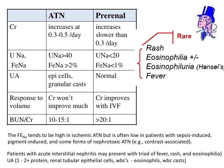 19 Shoeb Bin Islam Acute Renal Failure