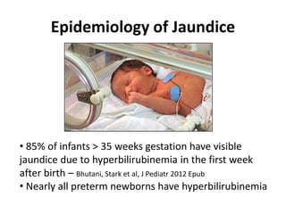 Premature Babies and Jaundice | PDF