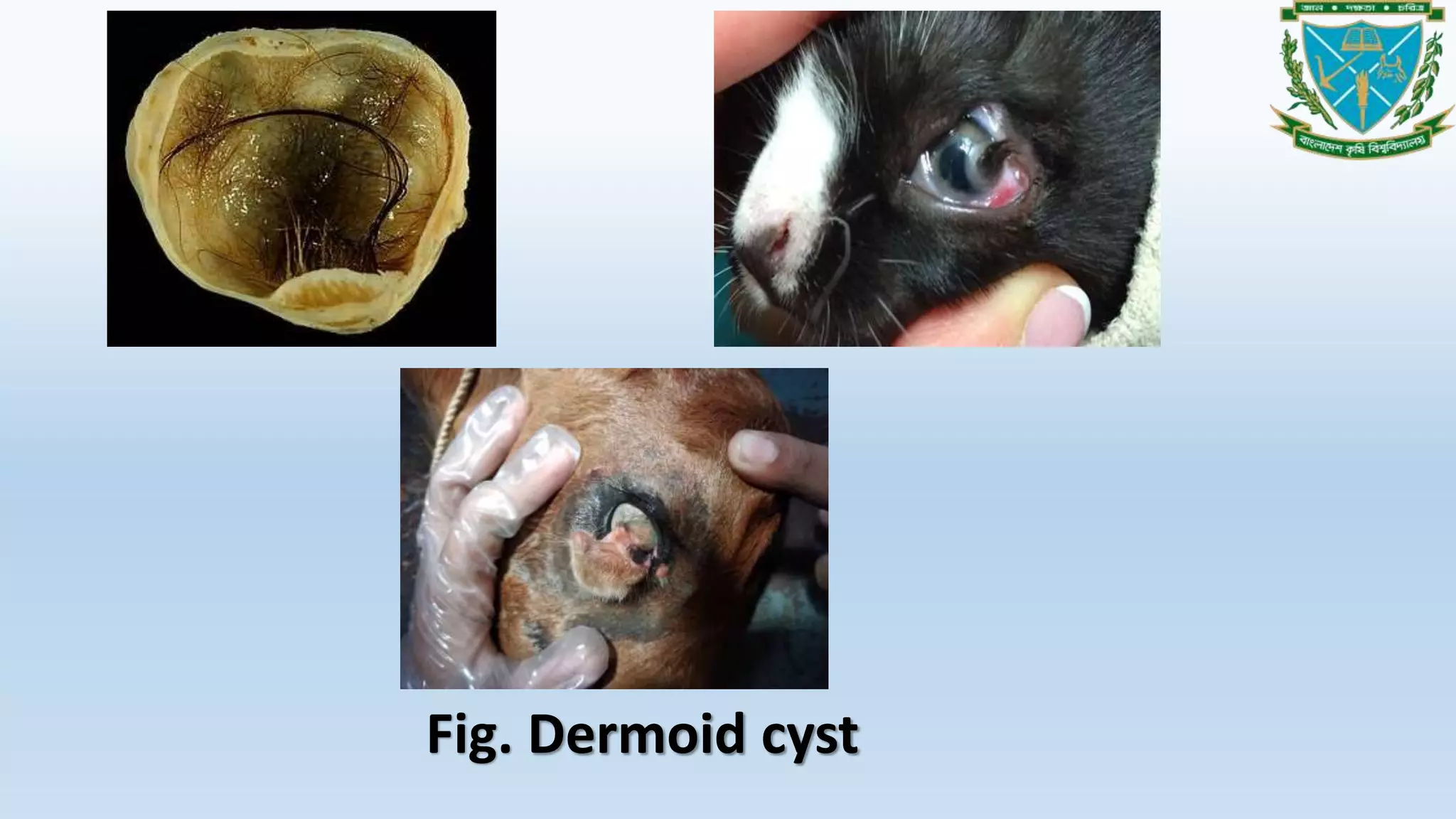 Tumor of the skin-types, general features of Benign and Malignant tumor ...
