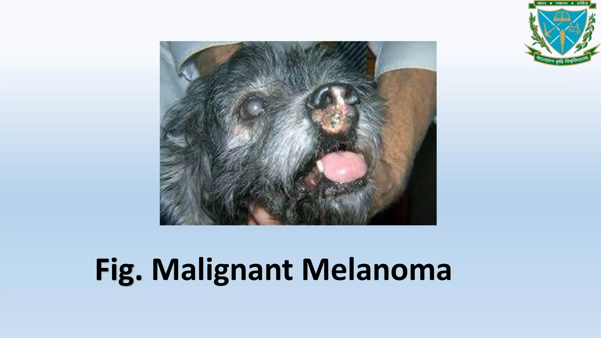 Tumor of the skin-types, general features of Benign and Malignant tumor ...