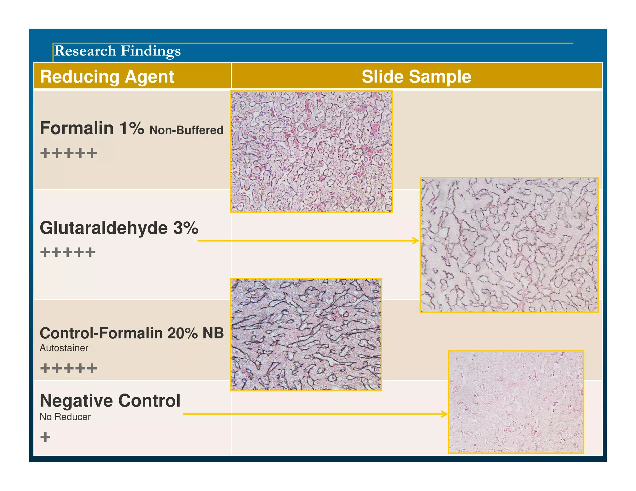 Gomori Reticular Fiber Stain RESEARCH 04-2016 Powerpoint | PDF