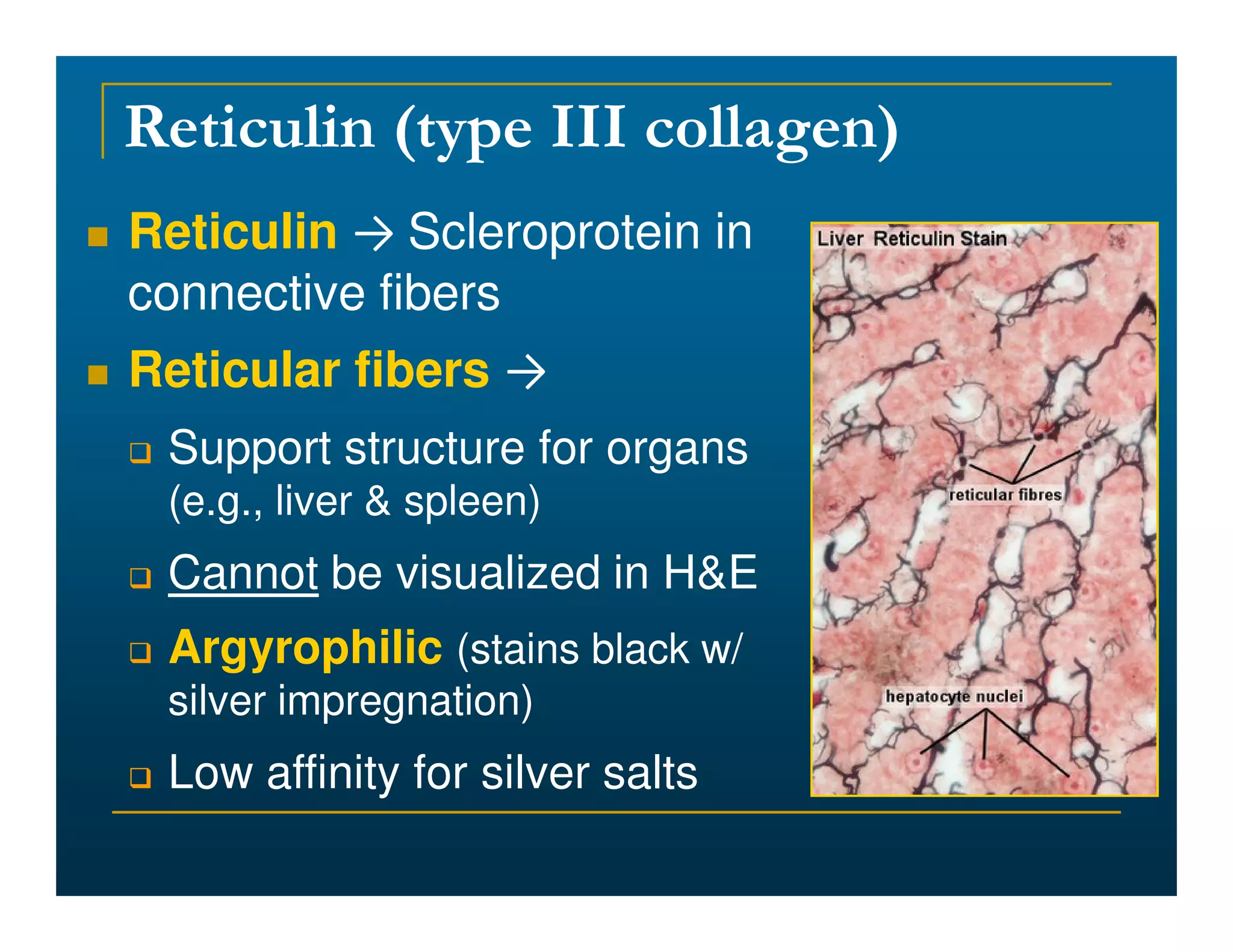 Gomori Reticular Fiber Stain RESEARCH 04-2016 Powerpoint | PDF