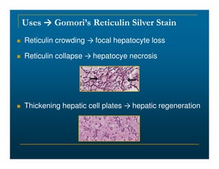 Gomori Reticular Fiber Stain RESEARCH 04-2016 Powerpoint | PDF