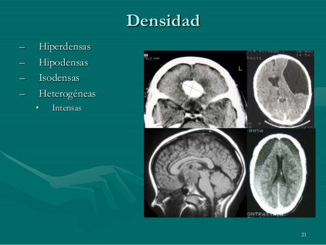 ABC DEL SNC PARA EL CURSO DE IMAGENOLOGIA DEL DR GERARDO SELA.