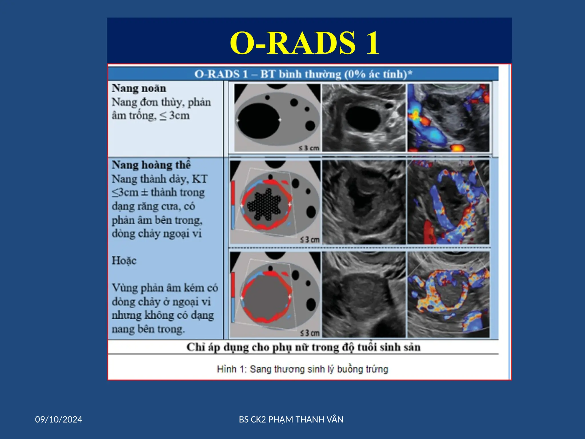 O-RADS 27-12-2023 Phan tang u buong trung.pptx