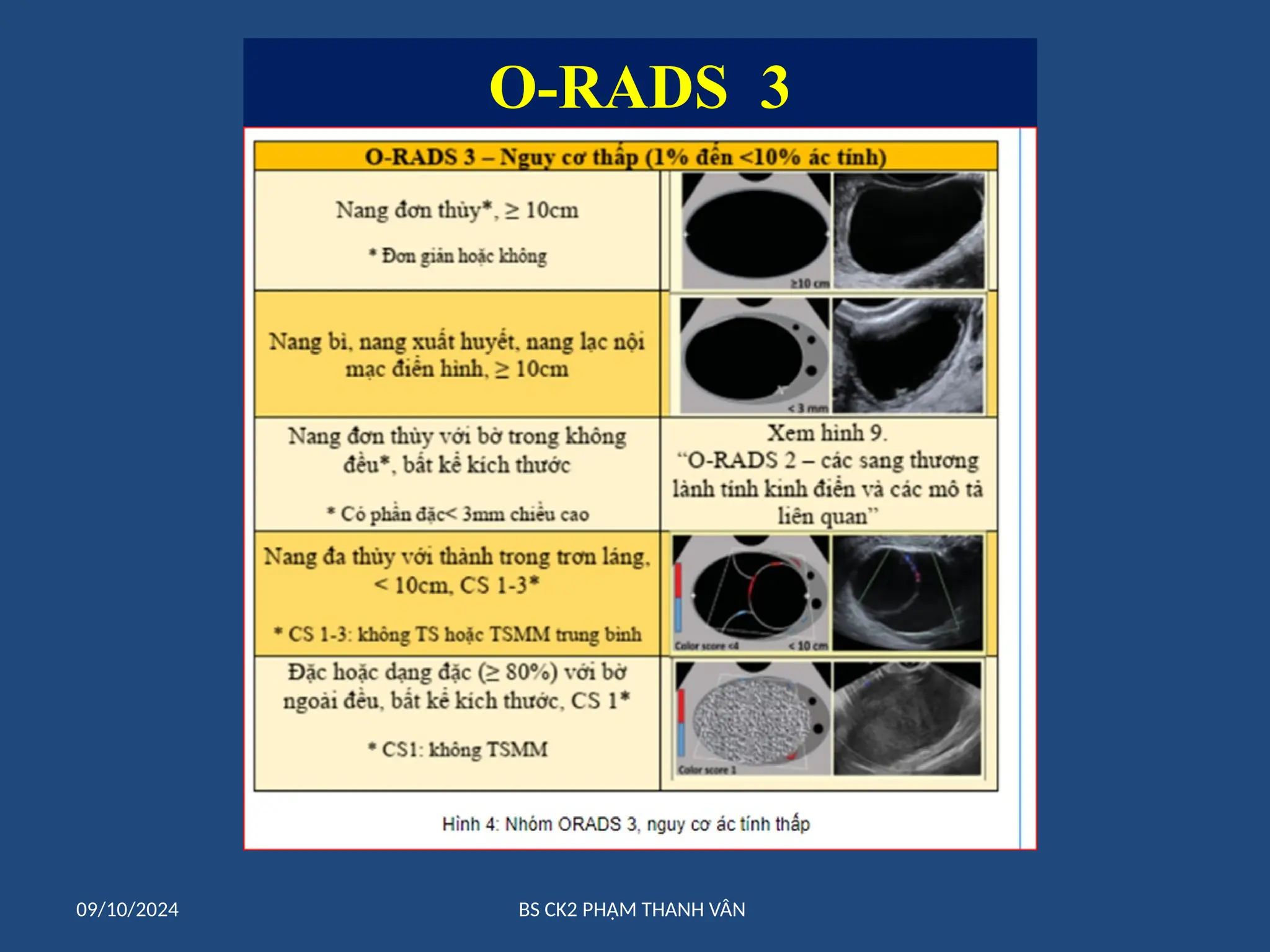 O-RADS 27-12-2023 Phan tang u buong trung.pptx