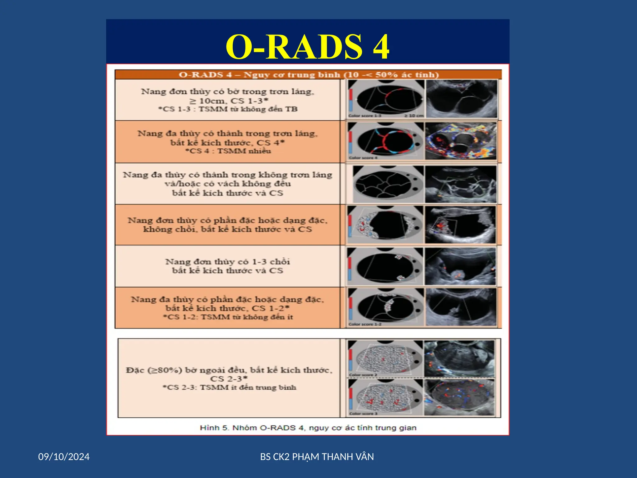 O-RADS 27-12-2023 Phan tang u buong trung.pptx