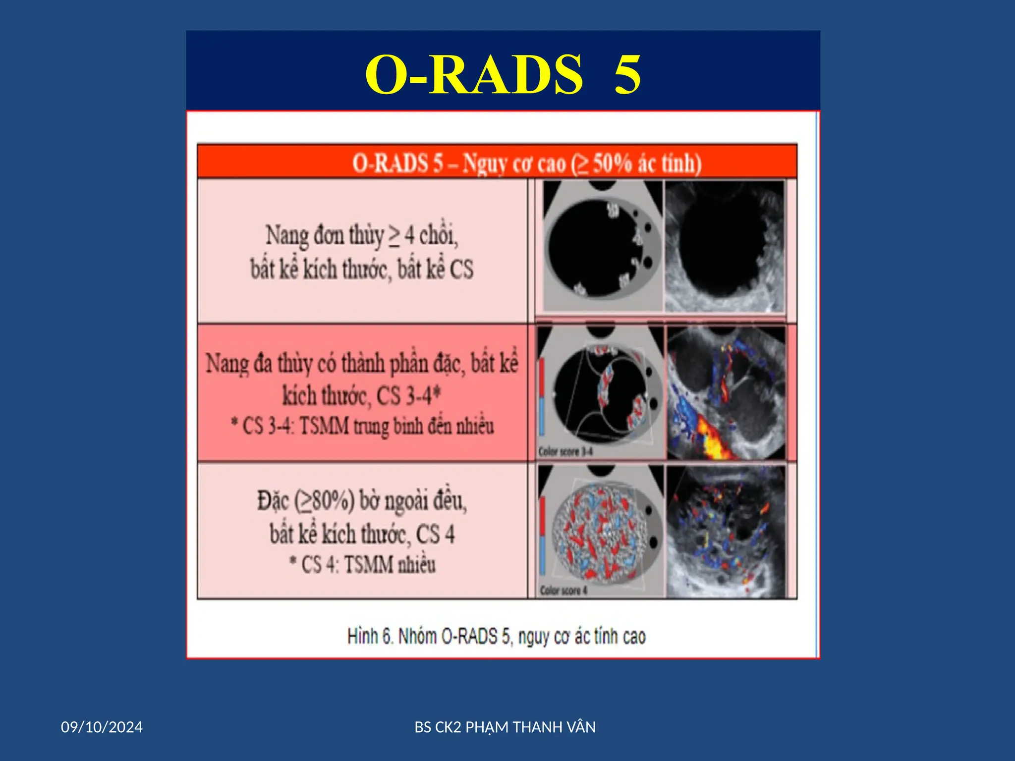 O-RADS 27-12-2023 Phan tang u buong trung.pptx