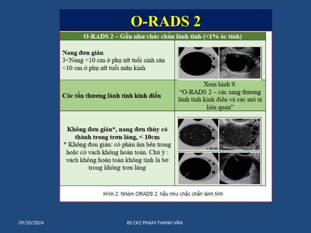 O-RADS 27-12-2023 Phan tang u buong trung.pptx