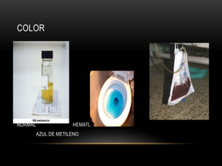 1ANALISIS DE ORINA.ppt