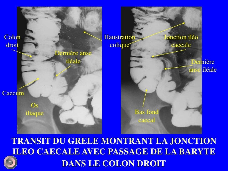 1 anatomie et semiologie rdiologique5 (version5)