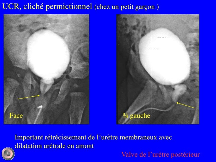 1 anatomie et semiologie rdiologique5 (version5)