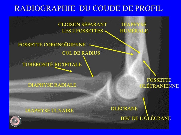 1 anatomie et semiologie rdiologique (version 1)